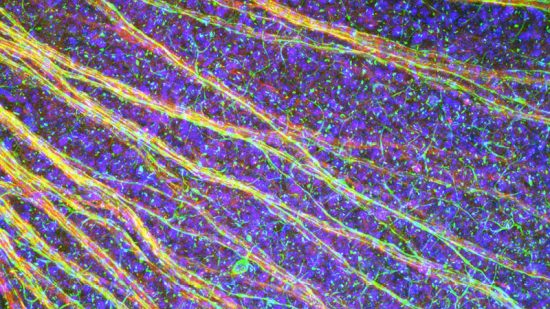 The eye as a window to the brain - DRFZ